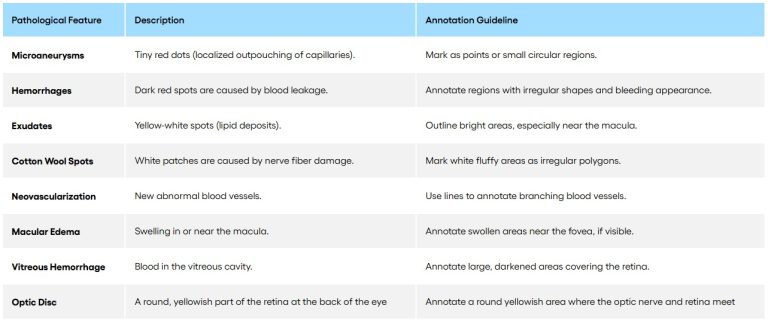 MulticoreWare’s Breakthrough in Diabetic Retinopathy – A collaborative success with a Medical R ...